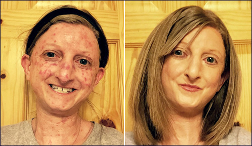 God’s Immunity Card | Aish